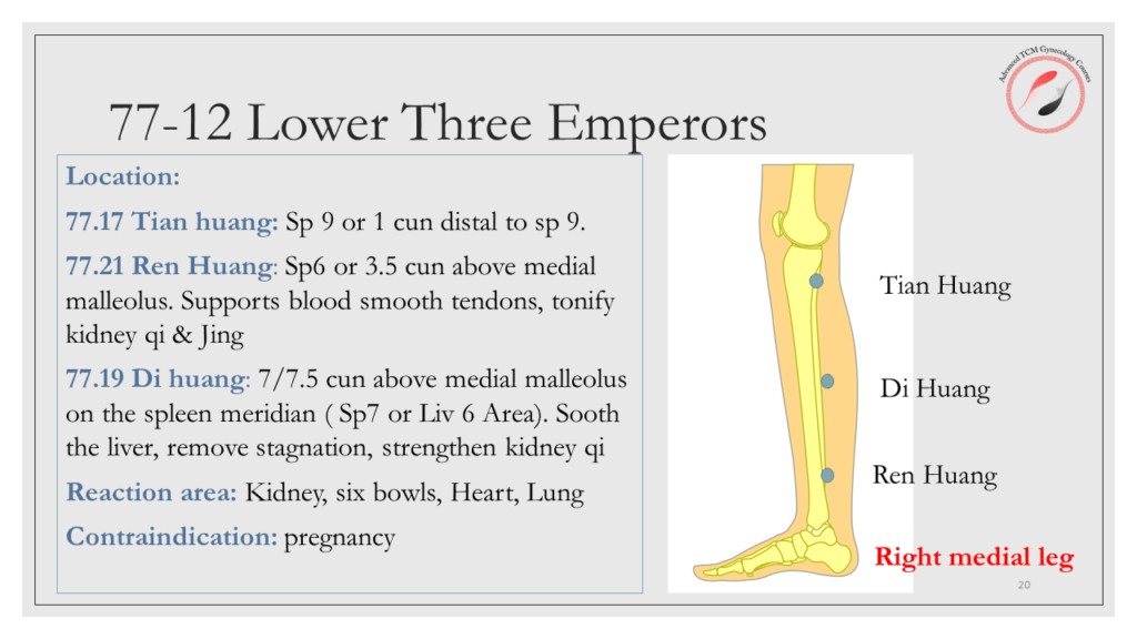 Chinese Medicine Treating Leucorrhea- Part two Acupuncture