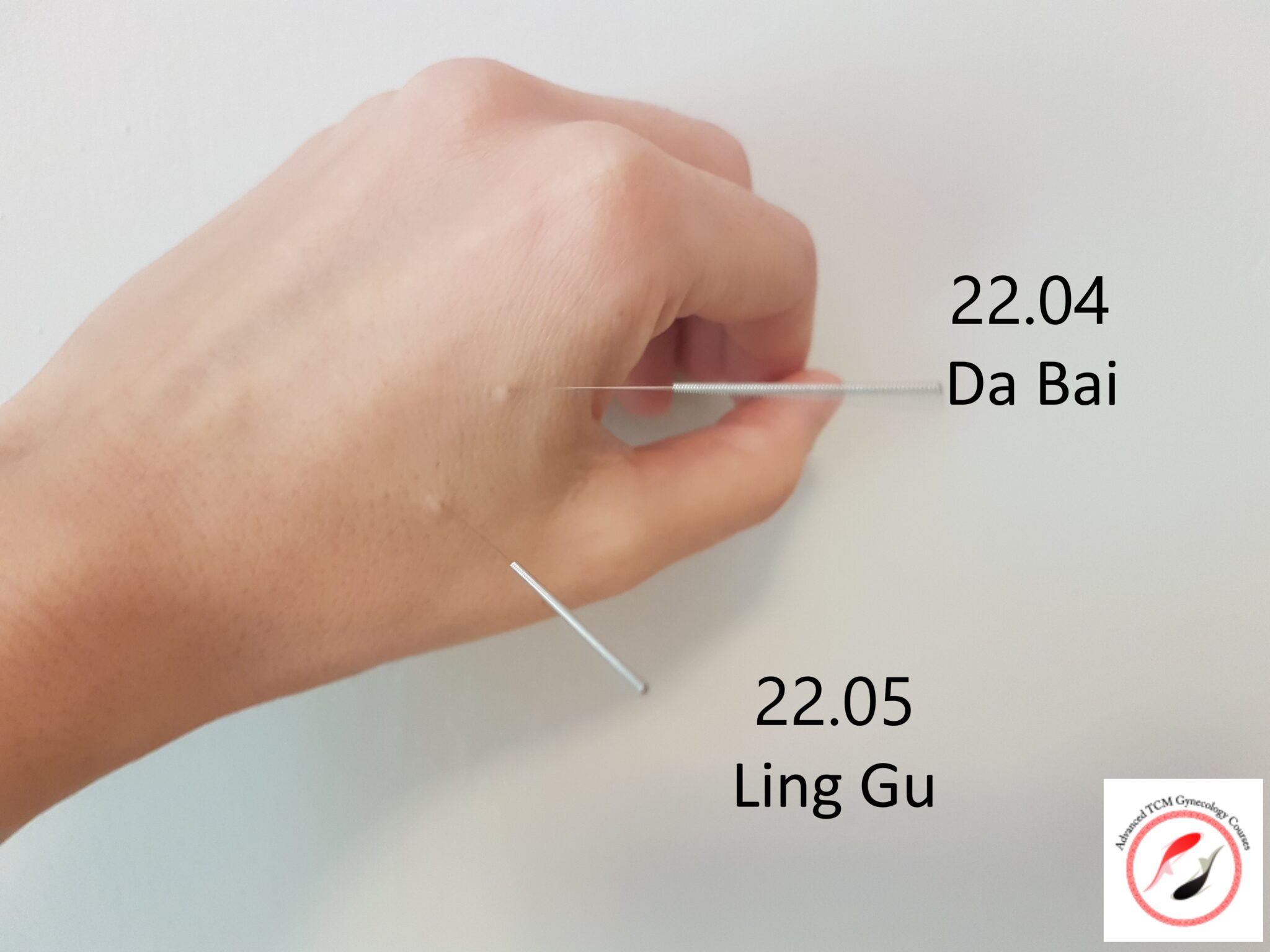 Ling gu【灵骨】22.05 and Da bai 【大白】22.04 Tung's Acupuncture Points - סינימד - רפואה סינית | דיקור ...