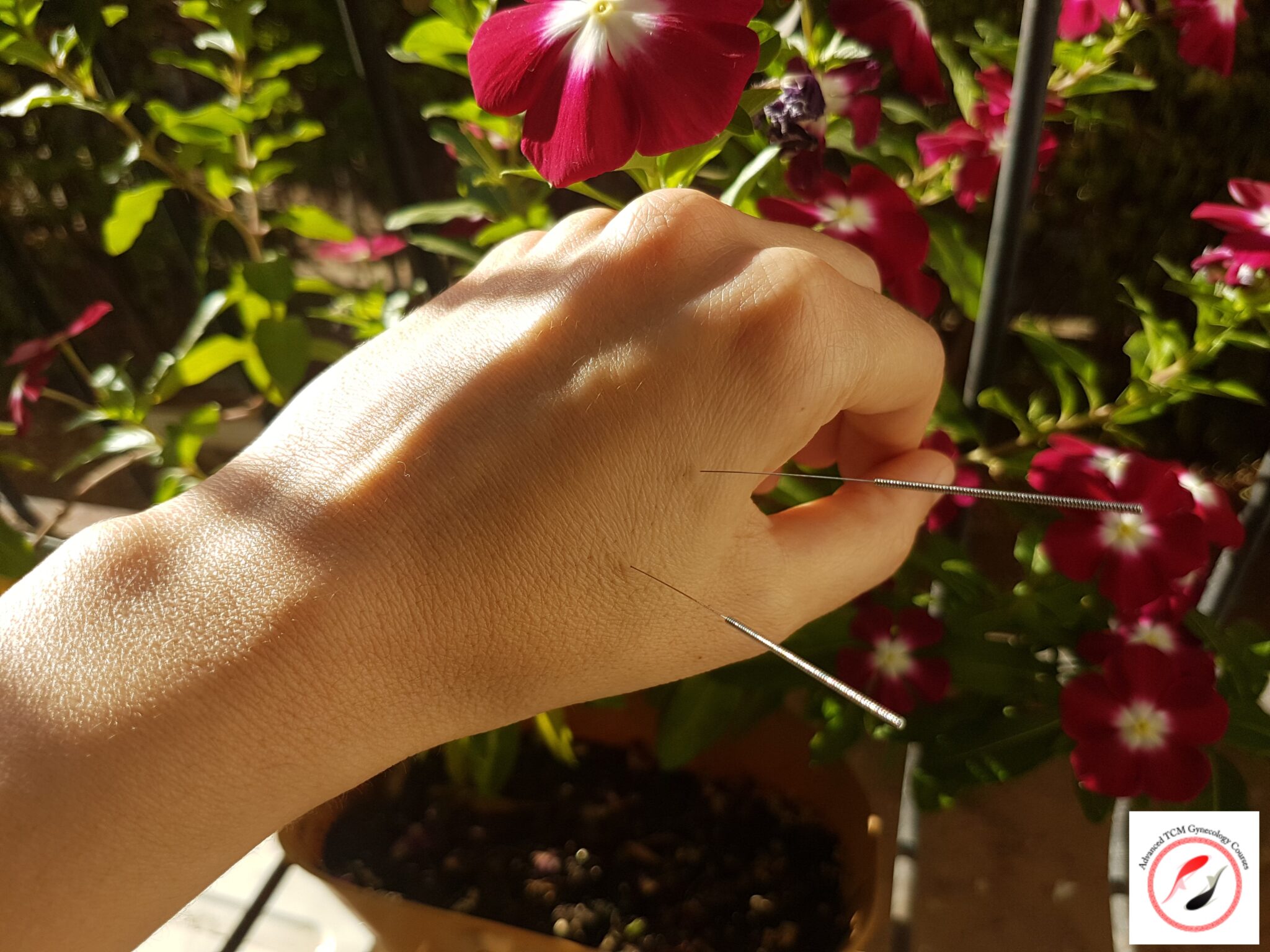 Ling gu【灵骨】22.05 and Da bai 【大白】22.04 Tung's Acupuncture Points ...