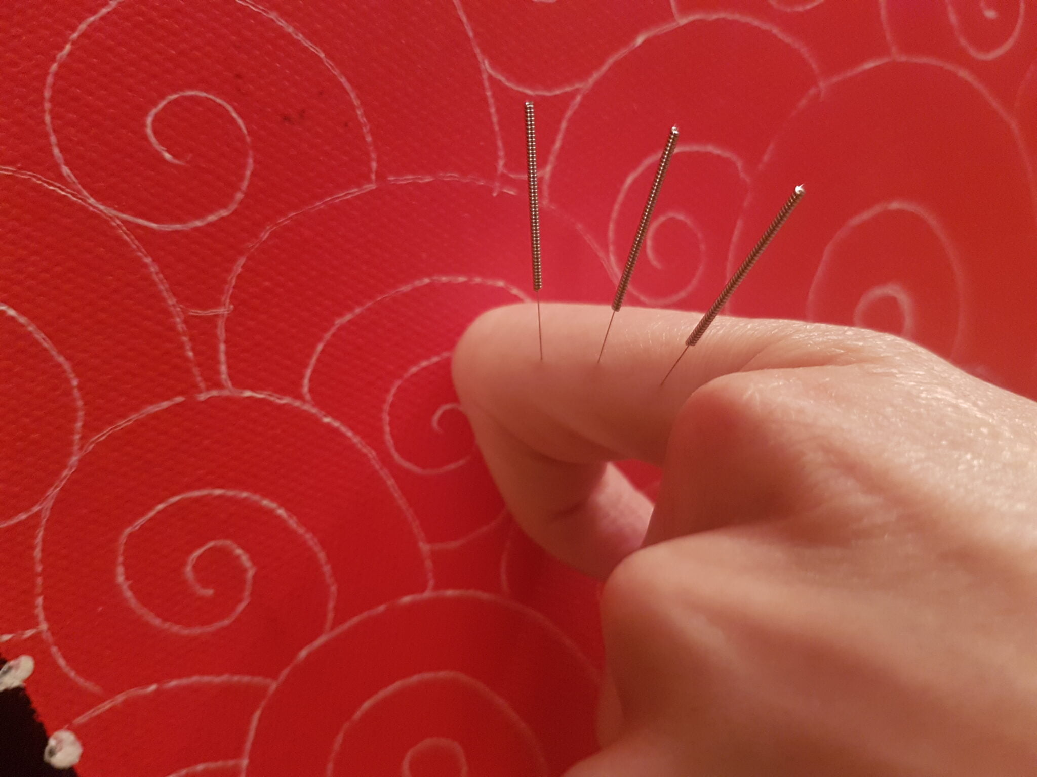 Ling gu【灵骨】22.05 and Da bai 【大白】22.04 Tung's Acupuncture Points ...