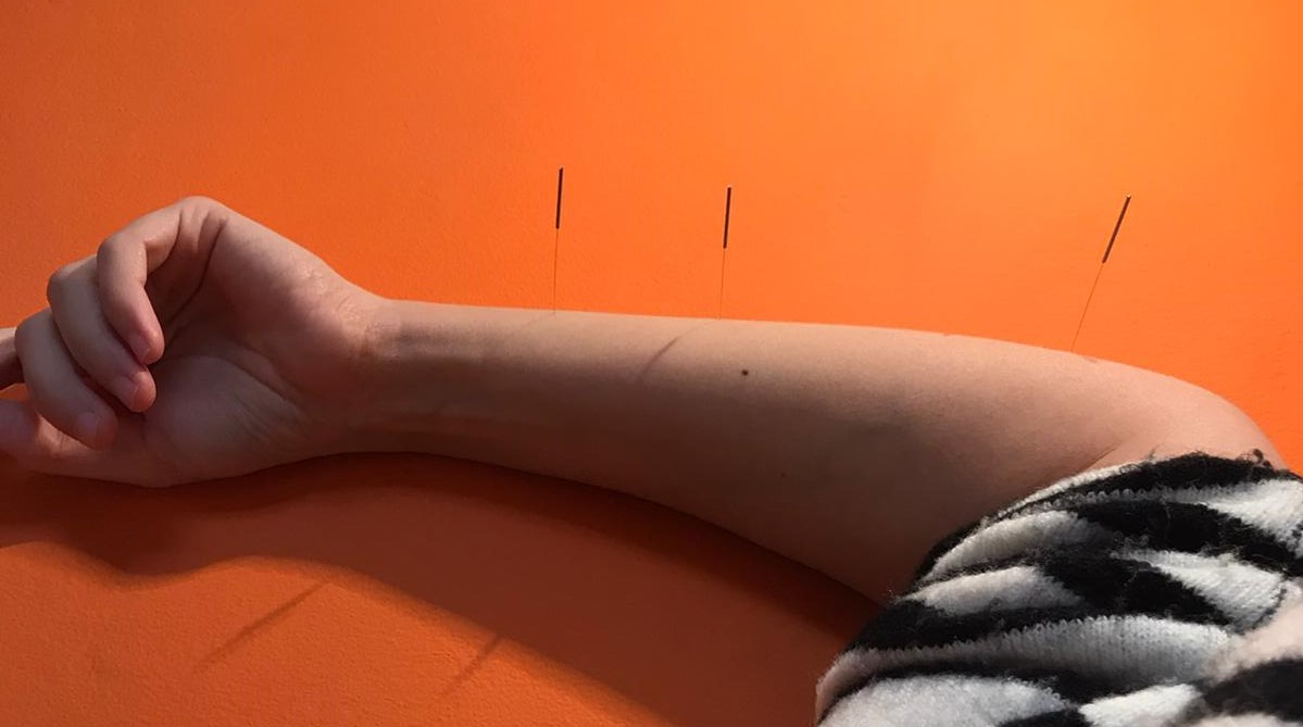 Master Tung's acupuncture: Chang men (33.10) Gan men (33.11) Xin men ...